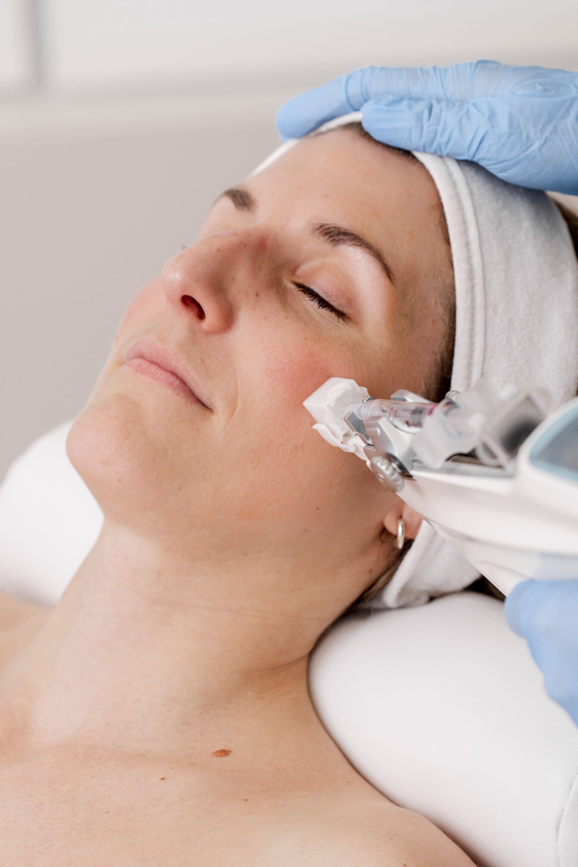 PRP Visage : revitalisez votre peau du visage au décolleté